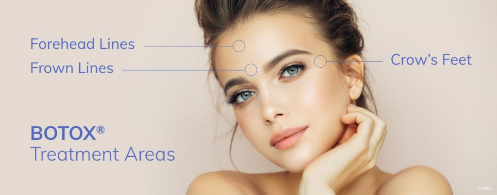 BOTOX® Cosmetic Injections for Naples & Fort Myers, FL – Kent V. Hasen, MD